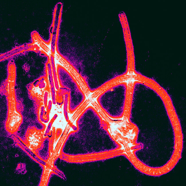 Unravelling Ebola via early detection - Genetic Literacy Project