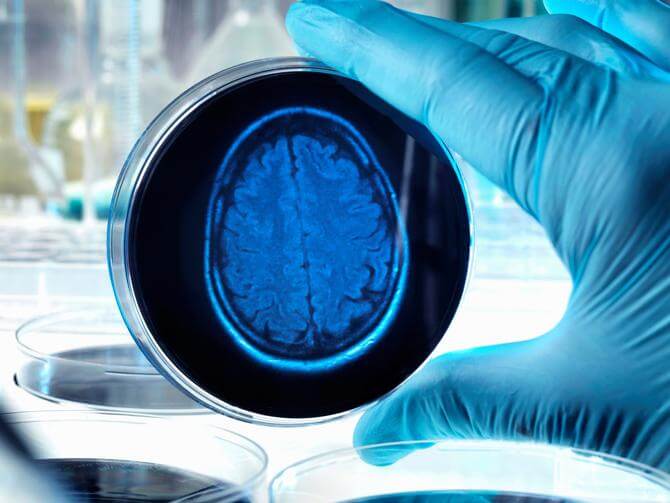 'Most complete' model of human brain grown in petri dish - Genetic ...