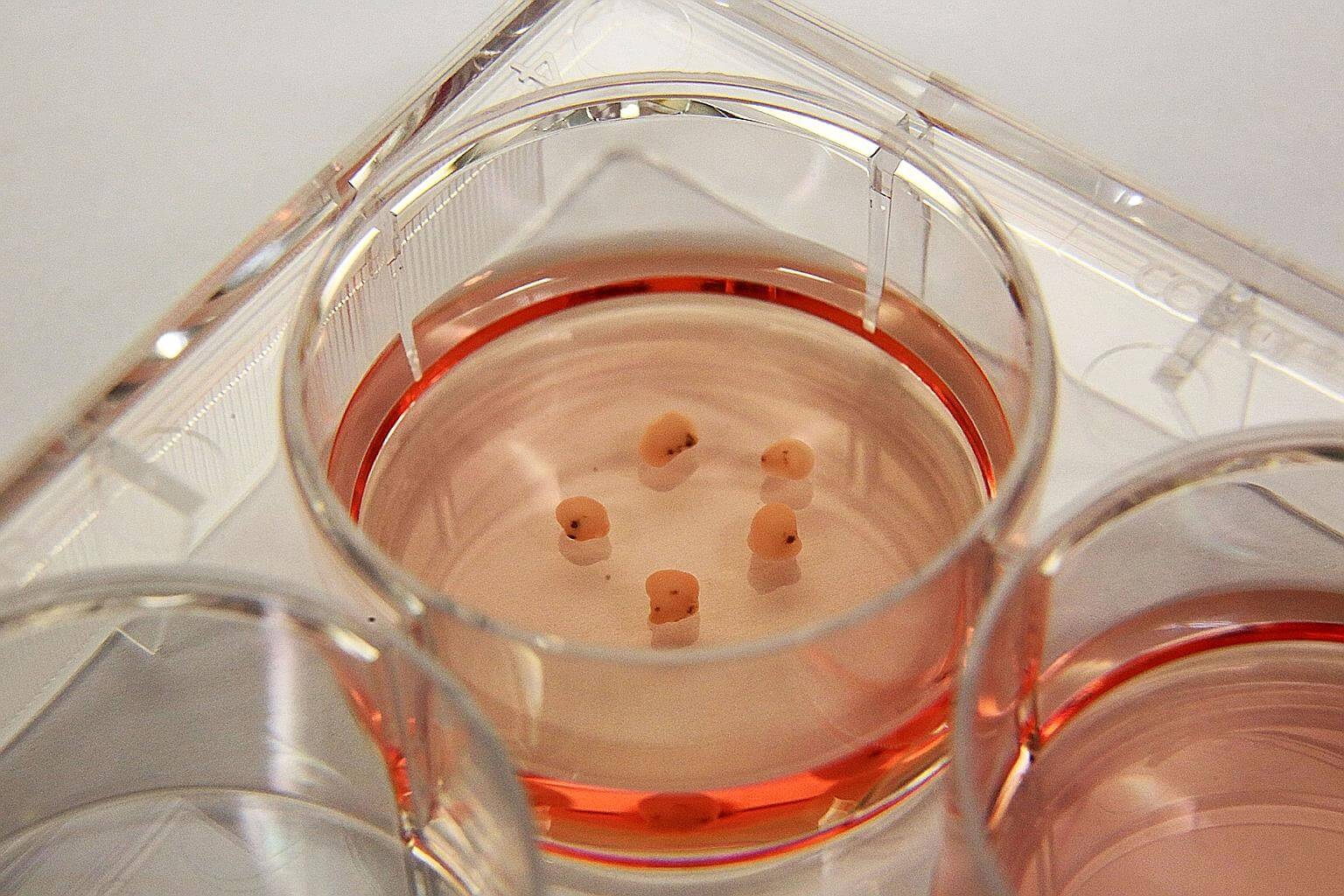 Mini 'brains' aid study of dementia and mental illness - Genetic ...