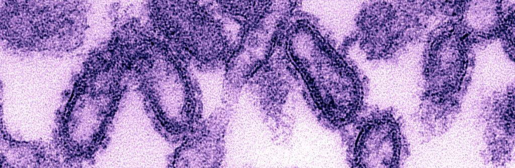Could modern influenza outbreaks escalate into devastating pandemics ...