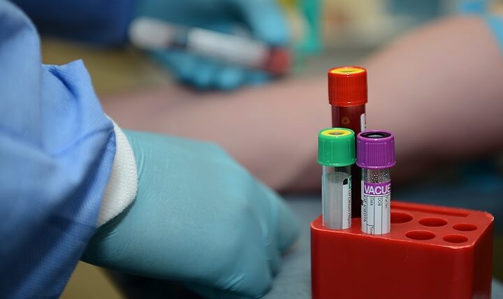 This 'simple blood test' could catch concussions missed by CT scans ...