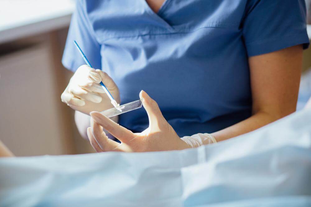 Viewpoint: At-home test detects cervical cancer early. It should be ...