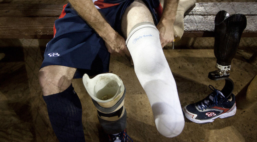 Regenerative medicine and war: The next breakthrough in treating ...