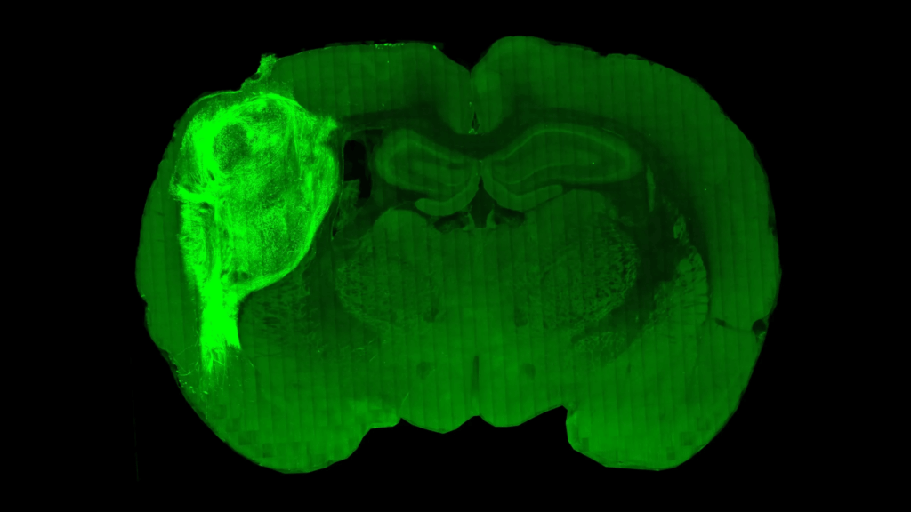 Human brain cells grown in rats offer ‘more ethical option’ to study ...