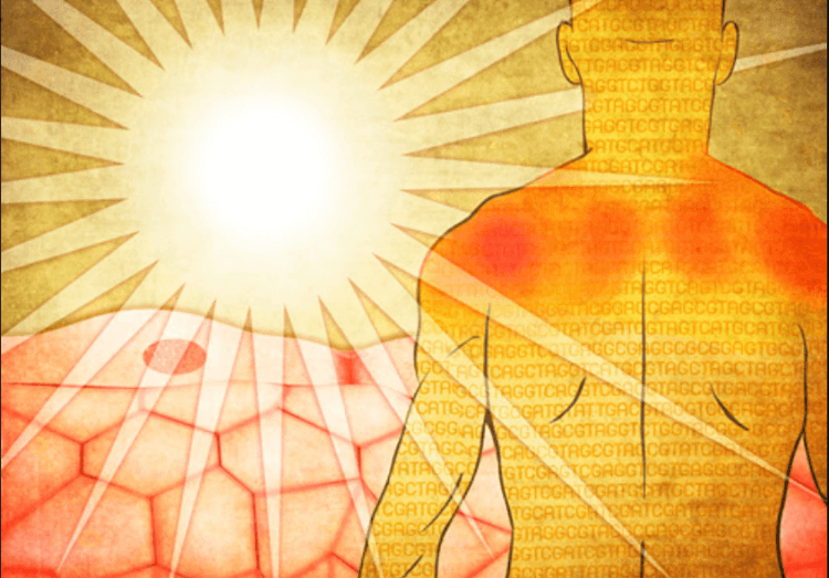 Ancient humans didn’t get sunburn. Here’s how living indoors has ...