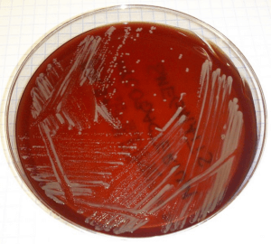 Electricity from thin air? Energy-producing bacteria has ‘potential to ...