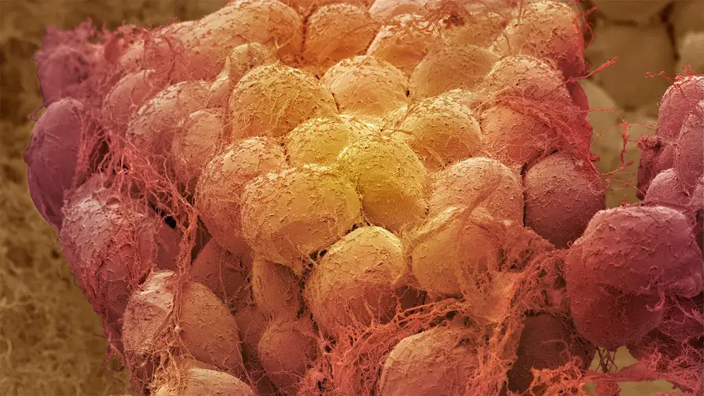 Memory of obesity: Fat cells are at war with your diet - Genetic ...