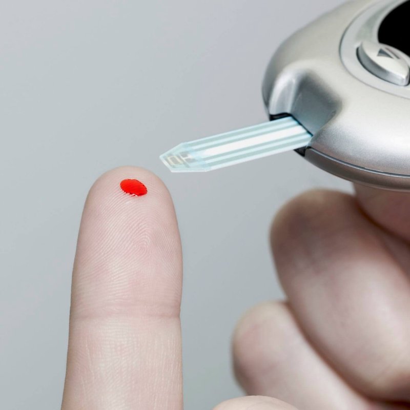 Genetically modified skin grafts could monitor glucose, end needle ...