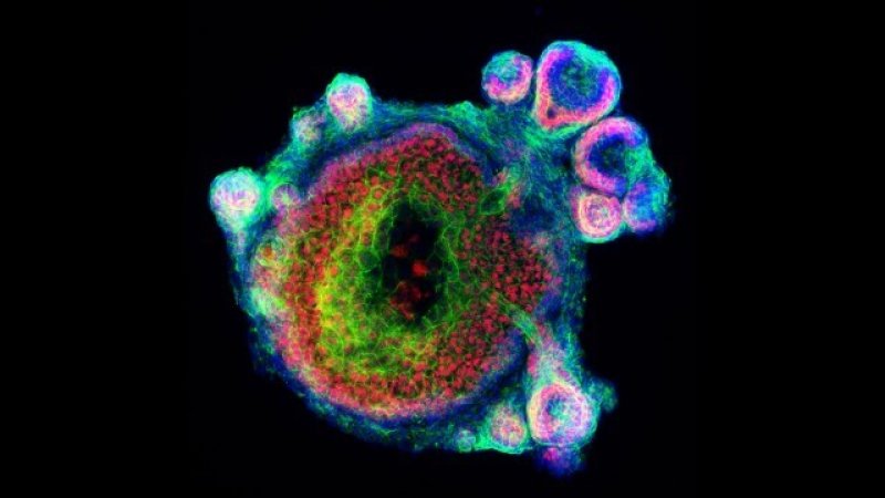 Viewpoint: Miniaturized organs made from stem cells — What are the ...